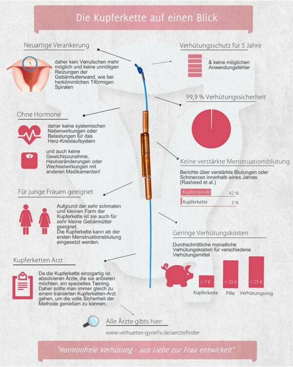 Die Kupferkette GyneFix - die moderne Kupferspirale