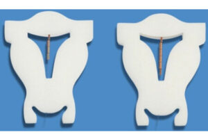 Die Kupferkette GyneFix - die moderne Kupferspirale